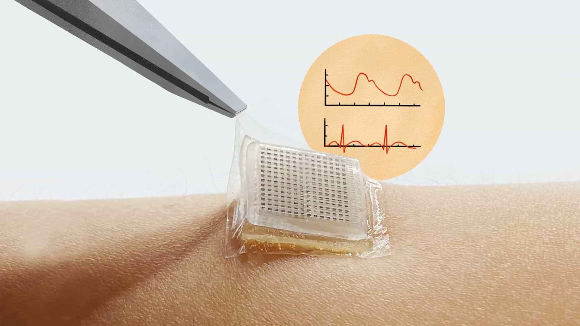 Wearable ultrasound patch could expand access to medical imaging ...